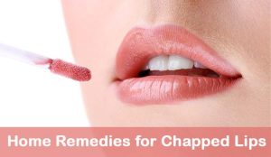 Chapped Lips Archives - Wellness.guide