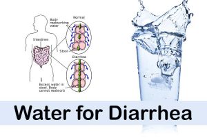 Does Water Cause Diarrhea | Coconut Water for Diarrhea