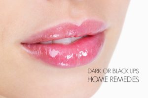 20 Best DIY Natural Home Remedies for Dark Lips