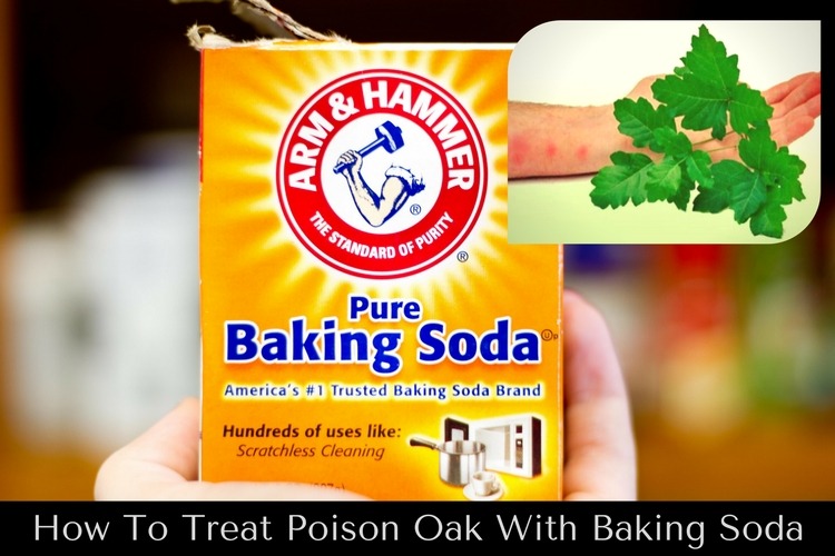 How To Treat Poison Oak With Baking Soda