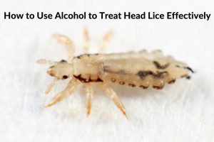 How To Use Mayonnasie To Kill Head Lice Effectively