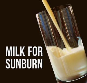 How To Treat Sunburn With Milk: 15 Effective Methods