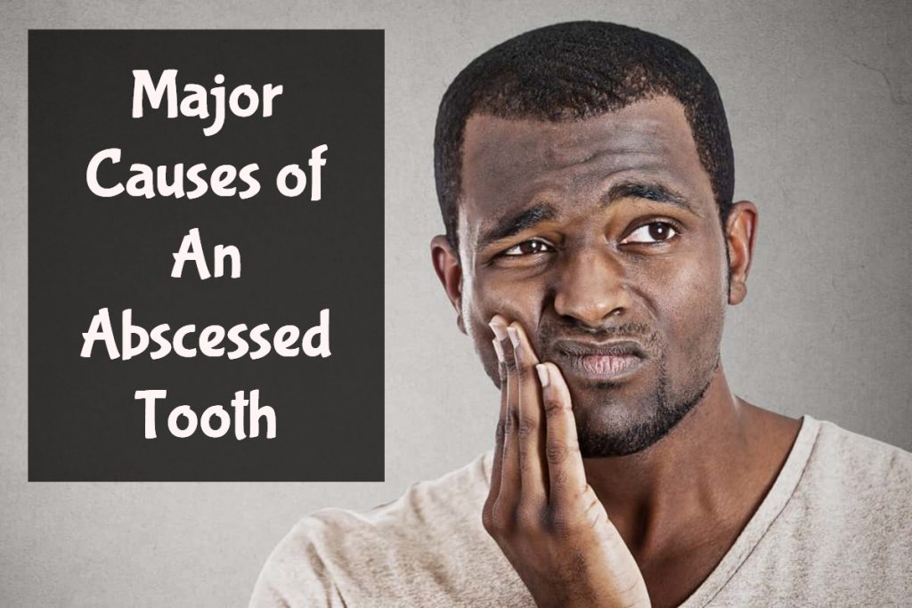 19 DIY Home Remedies To Get Rid Of An Abscess Tooth – Wellness.guide